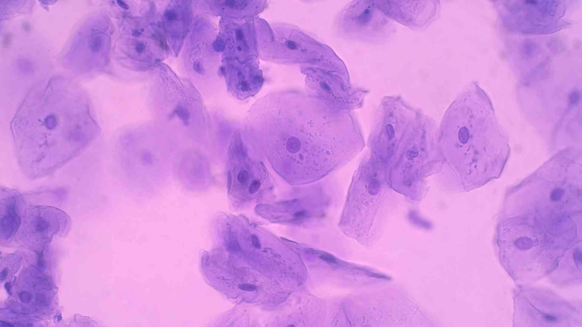 Comprendre l'autophagie : l'auto-nettoyage cellulaire & Santé – MOLEQLAR